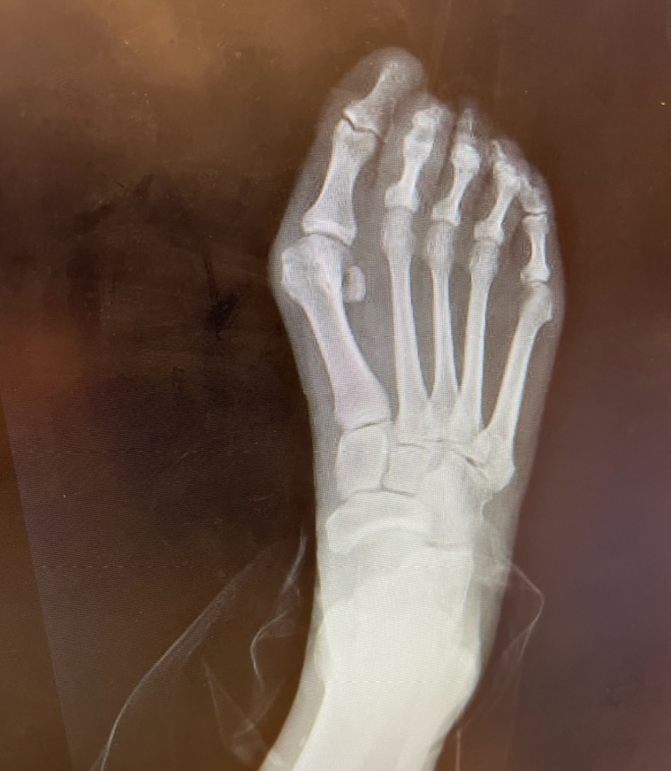 Sole asylum – GNASHING.